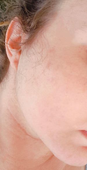 Danish Skin Care - Hudpleje til hudproblemer med effekt