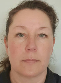 Danish Skin Care - Hudpleje til hudproblemer med effekt