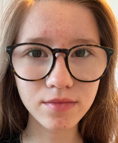 Danish Skin Care - Hudpleje til hudproblemer med effekt