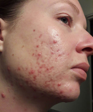 Danish Skin Care - Hudpleje til hudproblemer med effekt